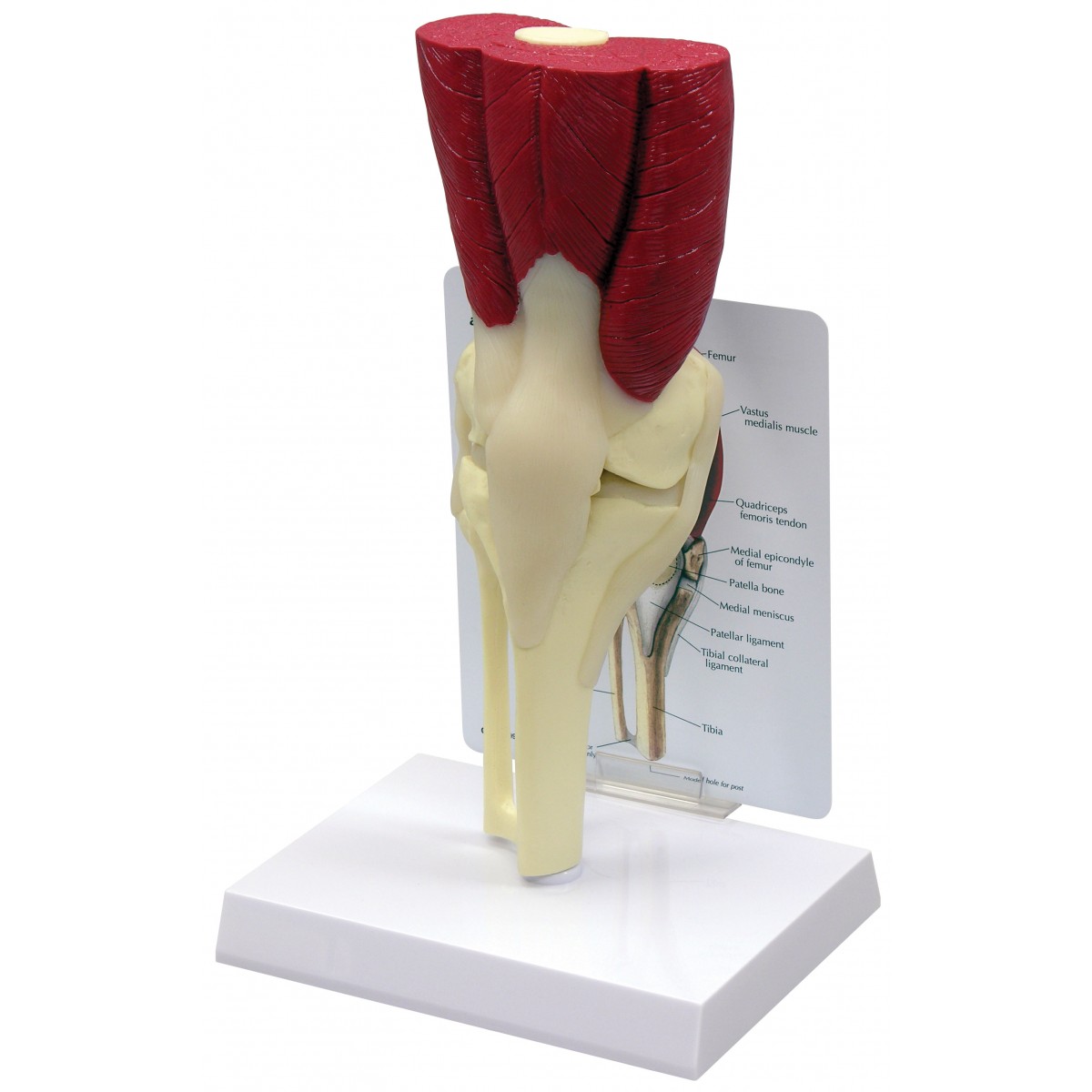 Knee Joint with Muslces - Joints - Skeletal System - Human Anatomy ...