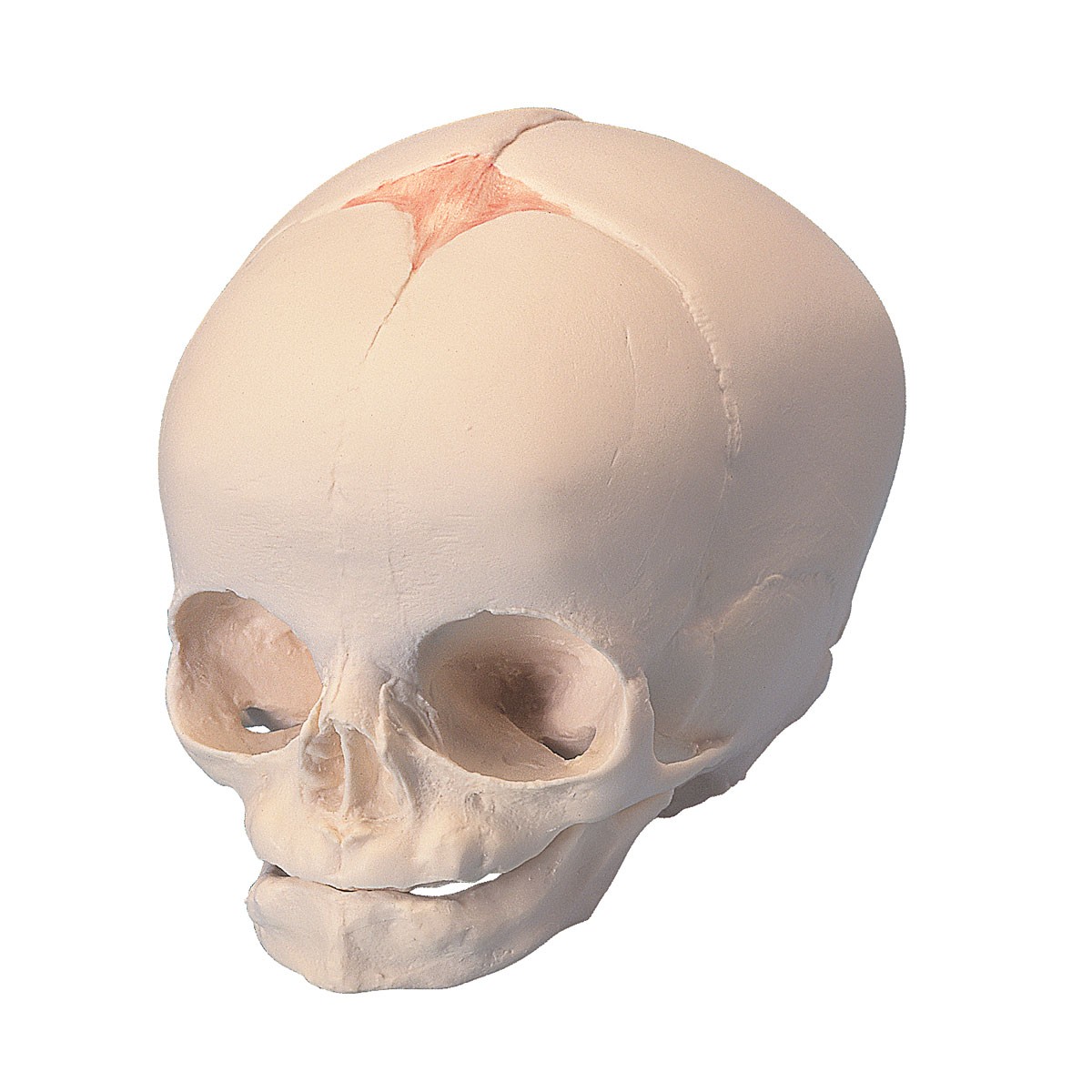 3B Fetal Skull