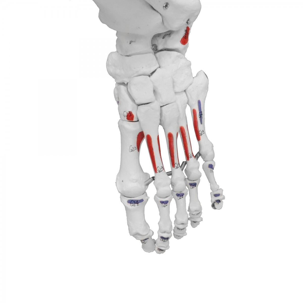 Walter Full-Size Flexible Skeleton w/Muscles - Skeletons - Skeletal ...