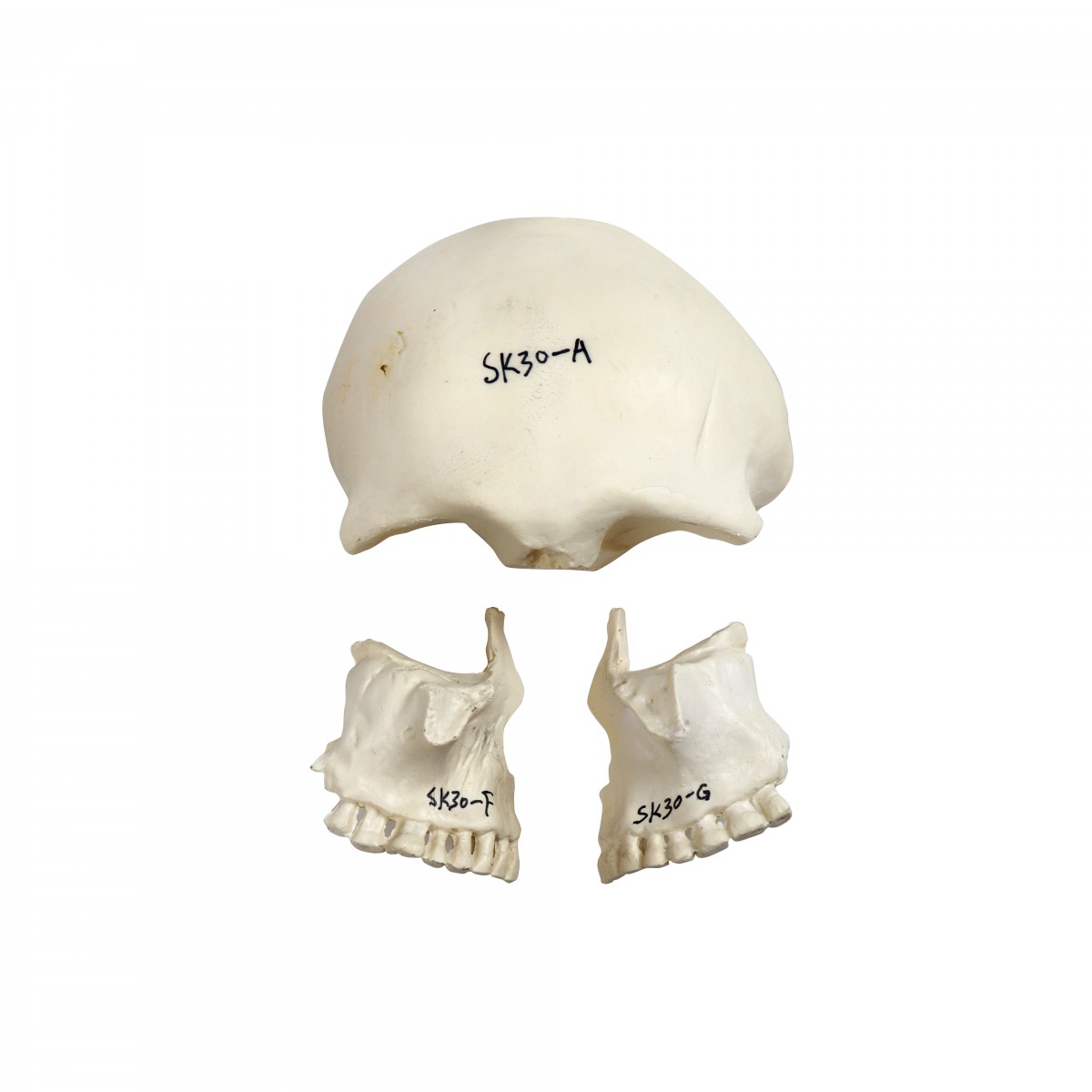 Walter Disarticulated Skull - Skulls - Skeletal System - Human Anatomy ...