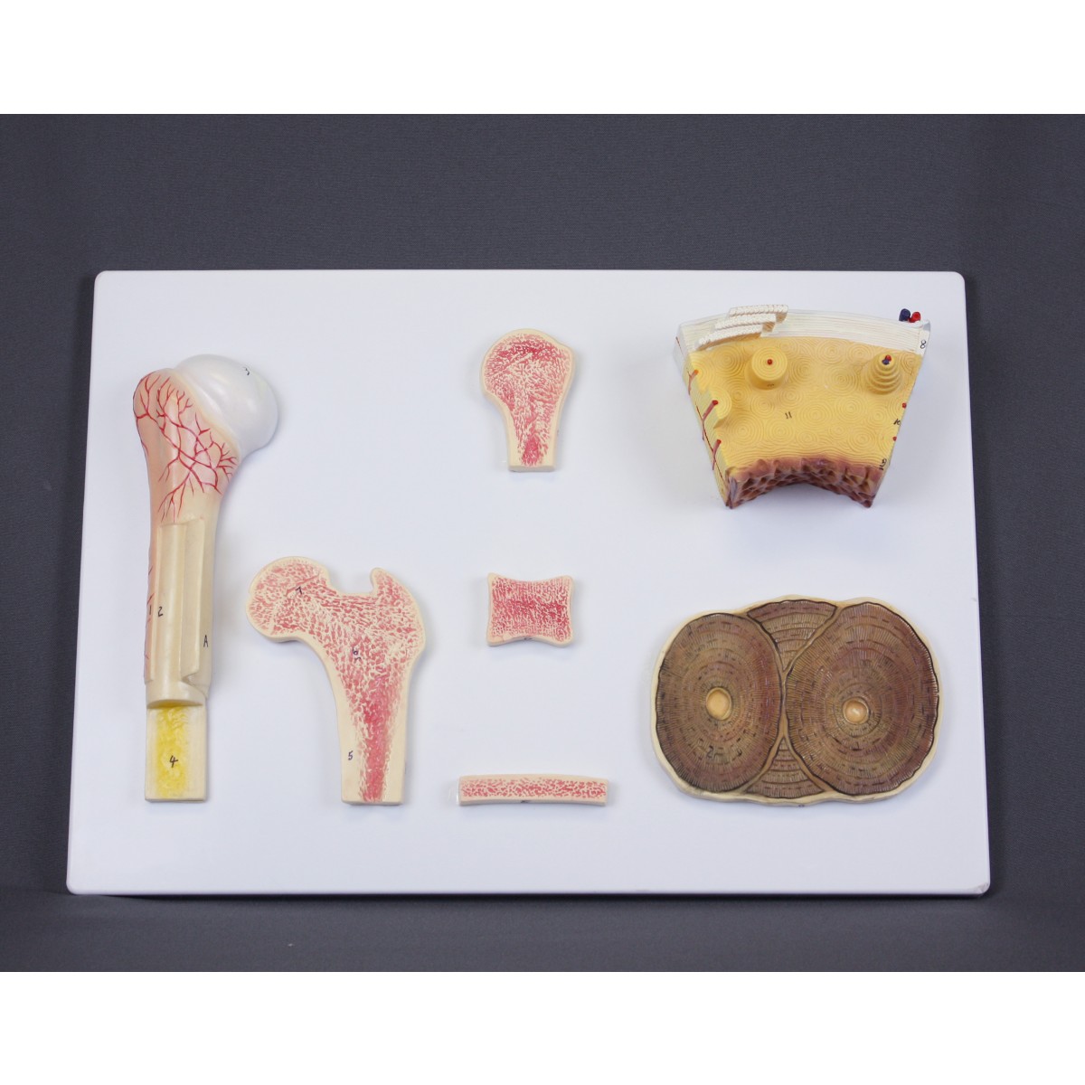 Walter Bone Tissue Model - Skeletal Components - Skeletal System ...