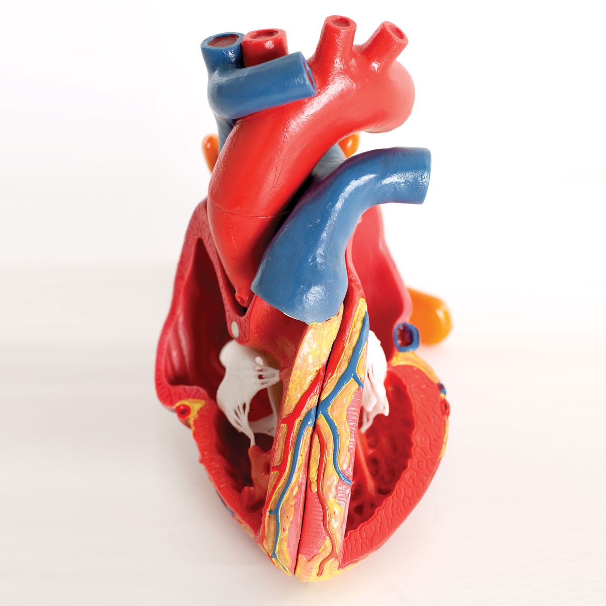 3B Heart Model w/Representation of Systole, Life-Size - 5 Parts ...