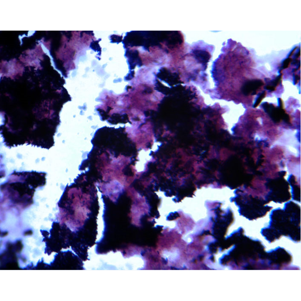 Deadly Human Diseases Prepared Slide Set - Slide Sets - Slides - Microscopy