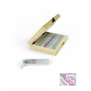 Human Pathology Prepared Slides - Prepared Slides - Slides - Microscopy